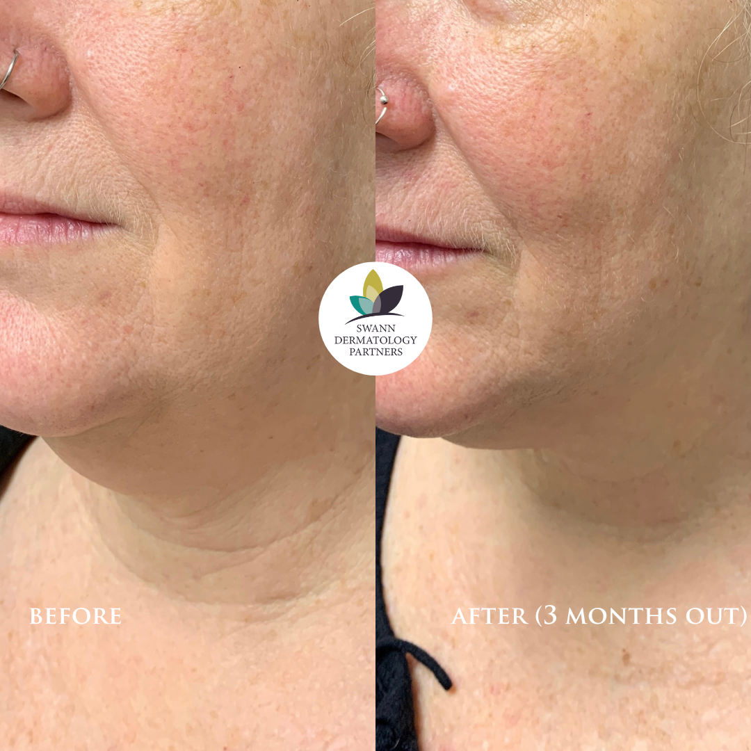 Gallery - Swann Dermatology Partners